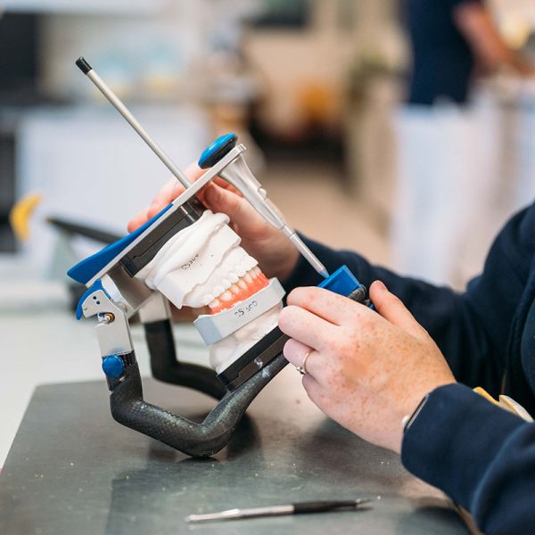 Vaste Prothese op op 4 implantaten - All on 4 - Vink Tandtechniek